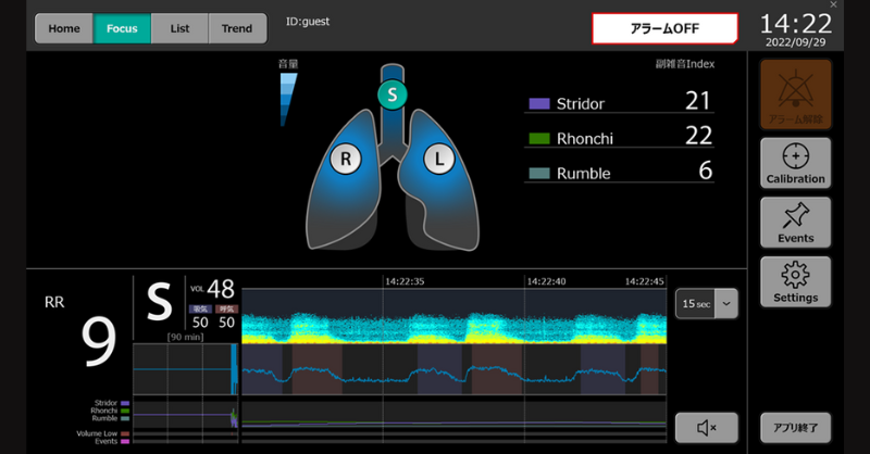 Novel device monitors breath sounds to predict respiratory failure in ...