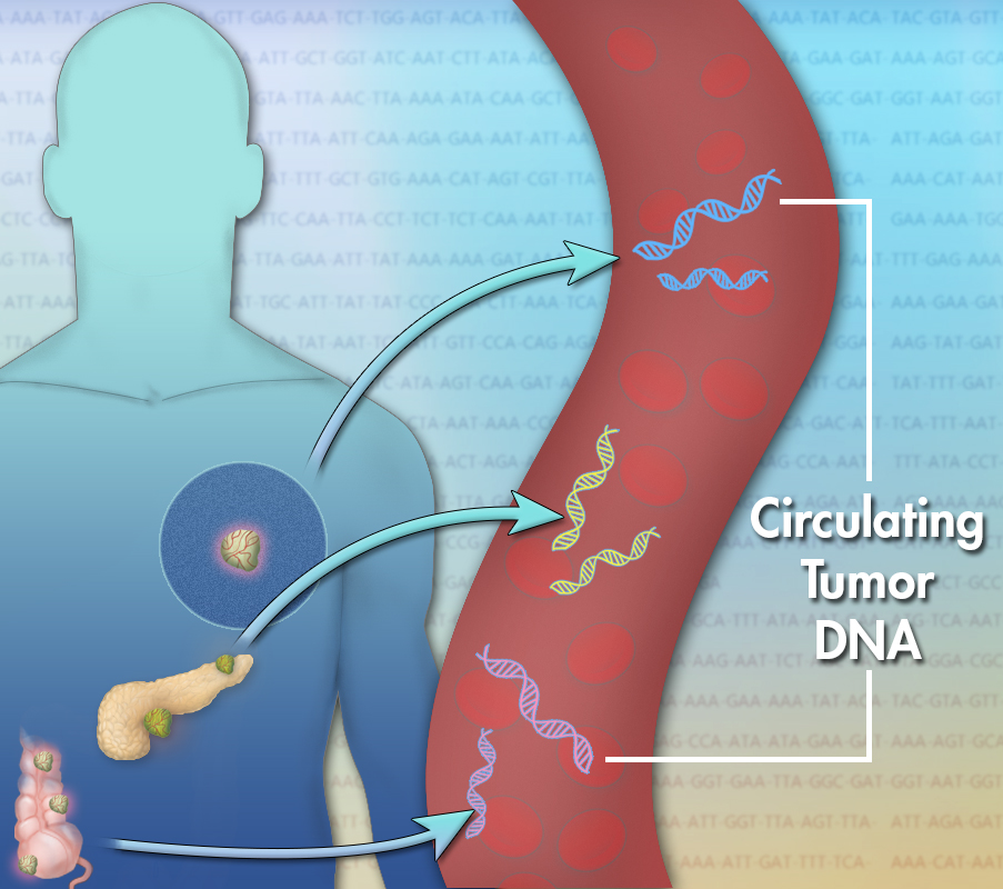 [Research]Studying cancer DNA in blood may help personalize treatment ...